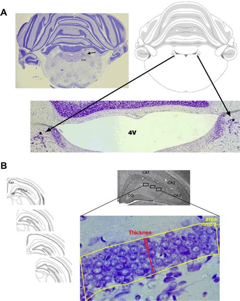 Histological Analysis Of The Locus Coeruleus And Dentate Gyrus A Locus