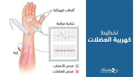 تخطيط كهربية العضلات كيف يتم عمله ولماذا يستخدم؟