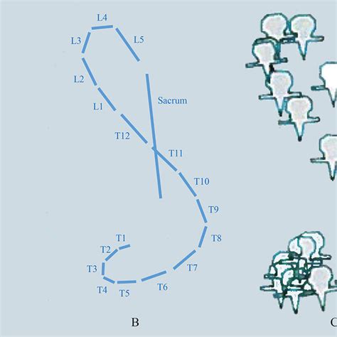17 Diagrammatic Illustration Of Bucket Handle Movement Of The