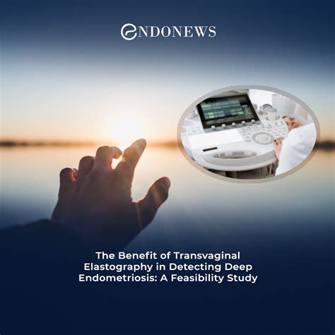 Another New Approach Could Help Diagnose Deep Infiltrating Endometriosis Endonews