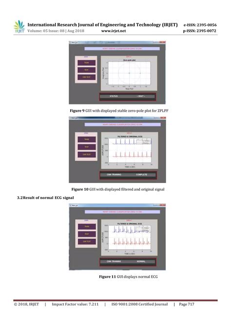 Irjet Arrhythmia Detection Using One Dimensional Convolutional Neural Network Pdf