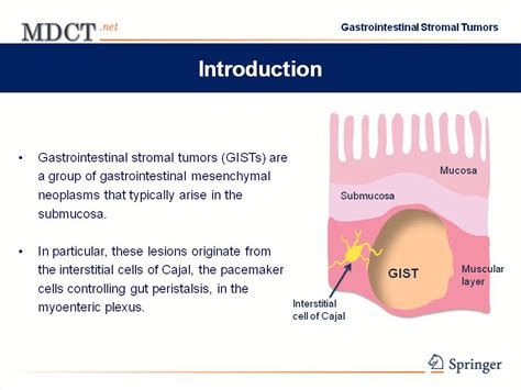 How To Treat Gastrointestinal Stroma Tumors A Guide Food Stamps
