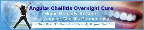 Neosporin For Angular Cheilitis Angular Cheilitis Natural Cure Angular Cheilitis Treatment