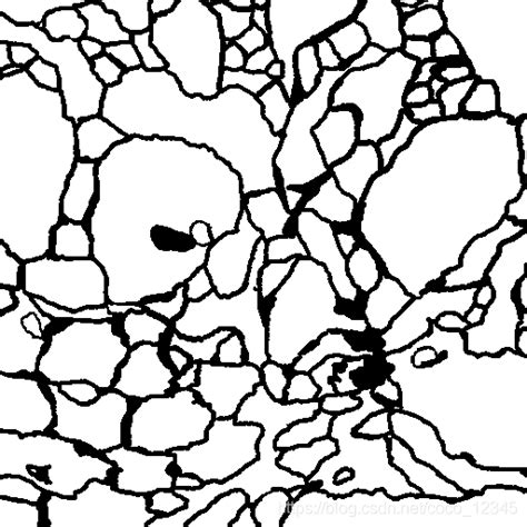 深度学习图像分割之unetunet图像分割 Csdn博客