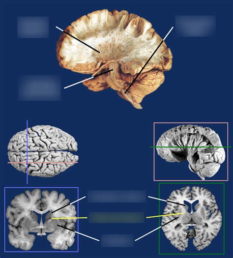 Pyramidal System Diagram Quizlet