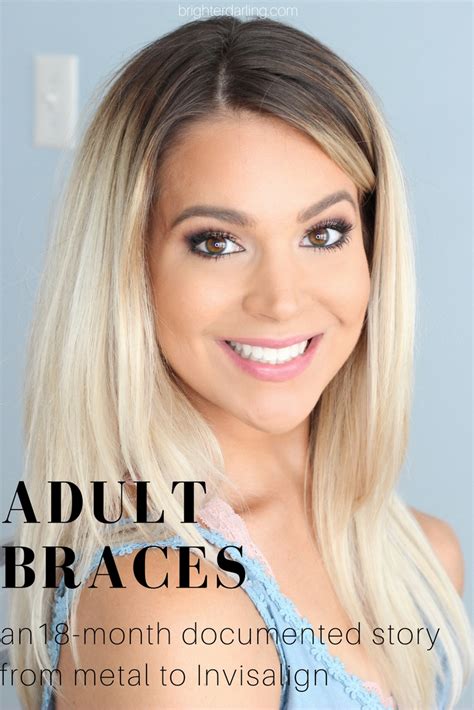 Adult Braces Update 13 The Grand Finale
