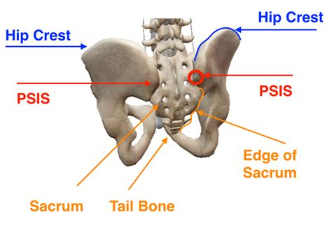 Psis Examiner Identifies Psis In Relation To Sacrum
