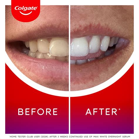 Colgate Max White Overnight Teeth Whitening Serum Colgate Max White