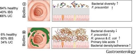 Mucosal Biofilms Are An Endoscopic Feature Of Irritable Bowel Syndrome