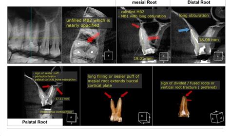 Dr Ahmed Alsayed On Linkedin Dental Cbct Educational Series