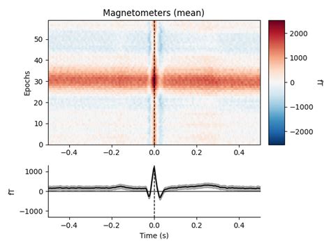 Overview Of Artifact Detection — Mne 1 3 1 Documentation