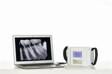 Factory Price Medical Digital Dental Xray Sensor X Ray Intraoral Clinic X Ray Sensor China