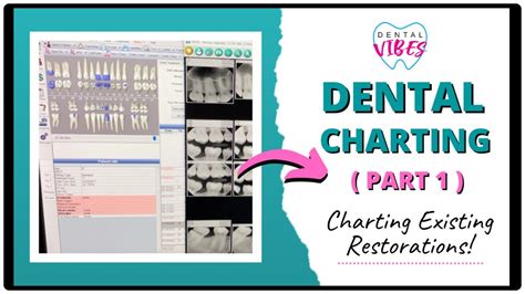 Dental Restoration Charting At Nichole Lowry Blog