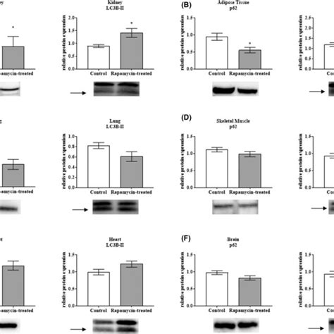 Influence Of Rapamycin On Tissue‐specific Expression Of Apoptotic