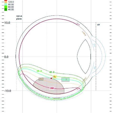 Ruthenium−106 Brachytherapy Planning System In Plaque Simulator Download Scientific Diagram