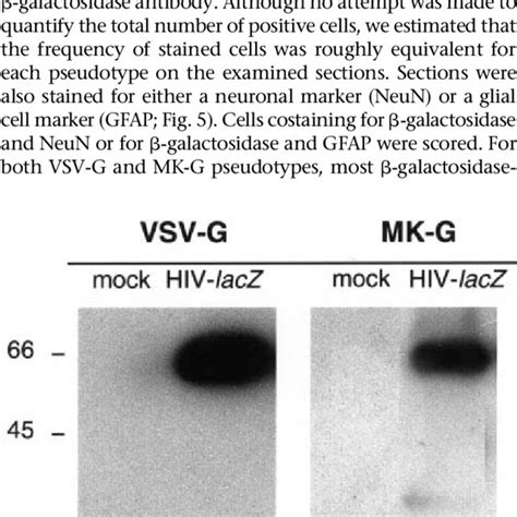 Morphology Of Hiv 1 Vector Particles Pseudotyped With The Vsv G Or The
