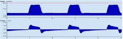Exma TMC Practice Exam Flashcards Quizlet