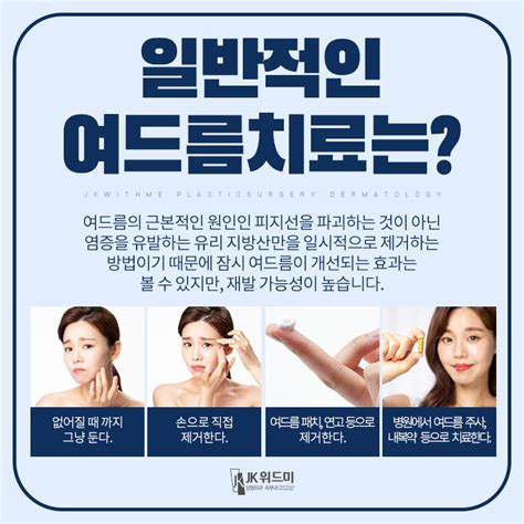Jk 위드미성형외과 피부과 피지선을 파괴하는 Jk위드미 아그네스 여드름의 근본원인이라고 할 수 있는