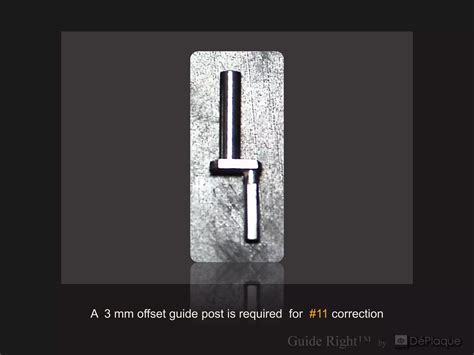 10 3 mm implants in narrow space angular and linear corrections ppt