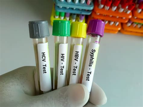Rapid Std Testing In Emergency Healthcare Advance Er