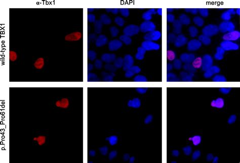 Subcellular Localisation Of Tbx1 Wild Type And Mutant Protein In