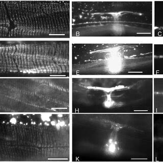 Rescue Of Ifa Mutants By Transgenes Carrying IFA GFP Deletion Download Table