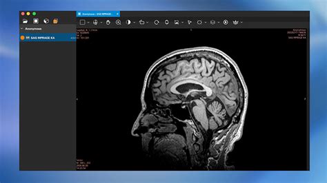 Bee Dicom Viewer Für Mac Und Windows Einfacher Betrachter Für Dicom