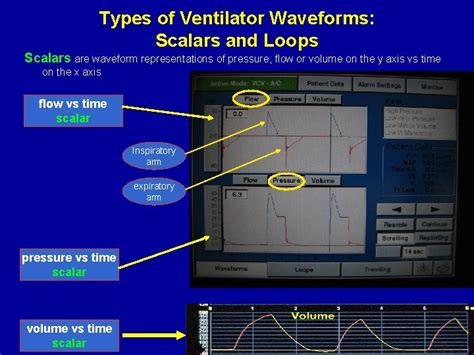 Ventilator Waveforms Basic Interpretation And Analysis Vivek Iyer