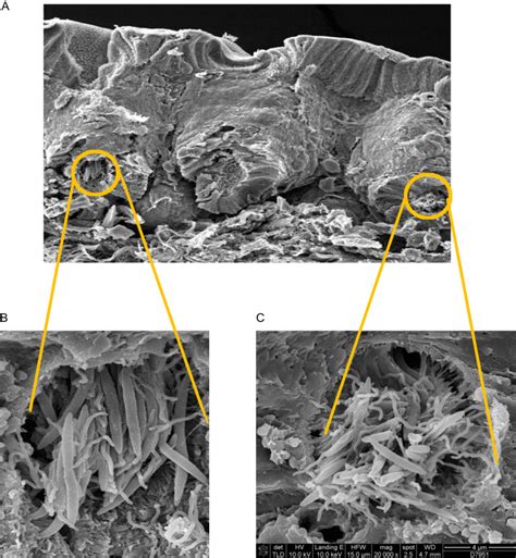 Spatial Compartmentalization Of The Microbiome Between The Lumen And Crypts Is Lost In The
