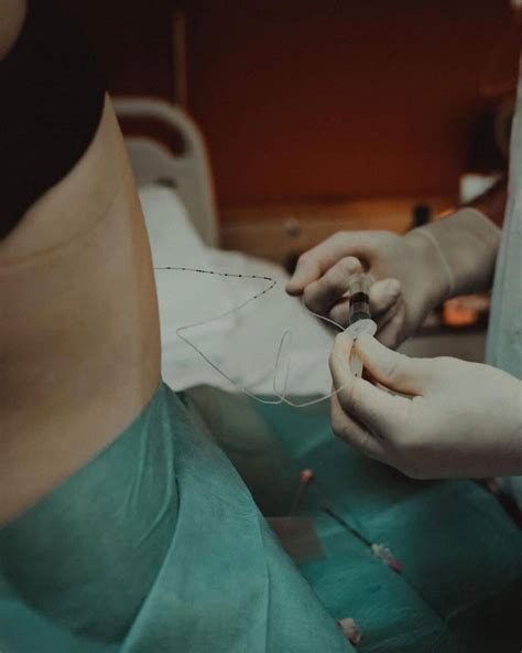 Epidural For Labour And Birth Benefits Risks And What To Expect