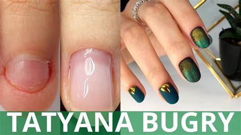 Extremely Bitten Nails Part 4 Huge Transformation On Former Bitten