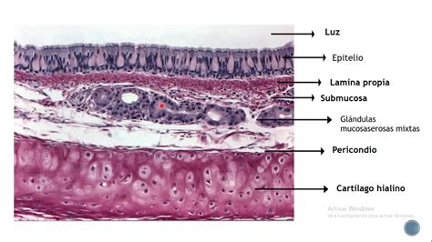 Traqueideos Sob Microscopio