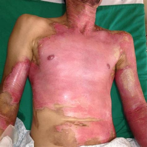 Biac Roboflow Universe