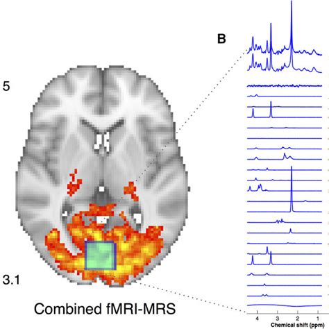 Each Repetition Time Tr Of The Combined Fmri Mrs Sequence Provides A Download Scientific