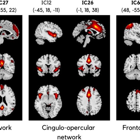 Spatial Maps Of Ics Comprising Selected Resting State Networks From The Download Scientific