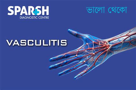 Vasculitis Sparsh Diagnostic Center
