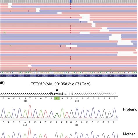A Schematic Showing The Integrative Genomics Viewer Reads Reverse