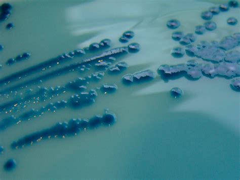 Archenland Enterobacter Cloacae Enterobacter My Xxx Hot Girl