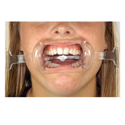 Lip And Cheek Retractors