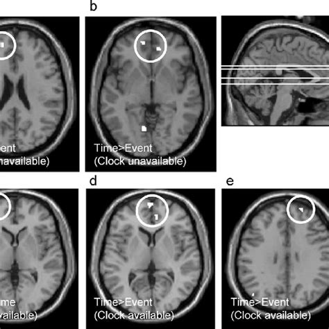 4 Areas Of Activation During Time And Event Based Prospective Memory