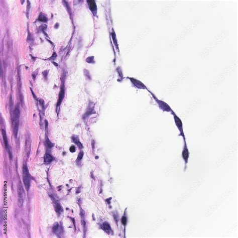 This Photo Shows Simple Squamous Epithelial Cells On The Surface Of The