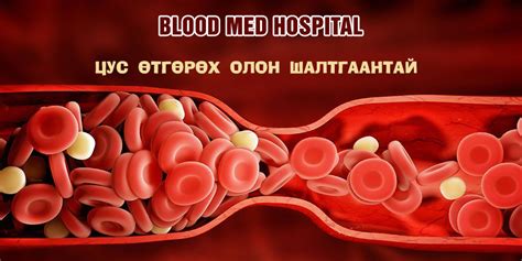 ЦУС ӨТГӨРӨЛТ ЧИМЭЭГҮЙ АЮУЛ Хордлого тайлах төв эмнэлэг