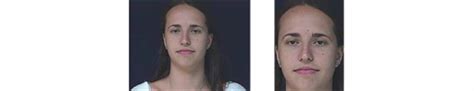 Example Of Preprocessing A Original Image B Cropped Image Download Scientific Diagram
