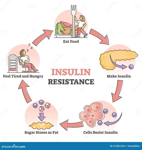 Insulin And Insulin Resistance Educational Sheet Royalty Free Stock