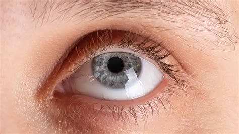 Symptoms Causes And Treatment Everything About Corneal Ulcer