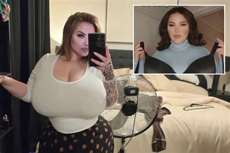 My P Cup Boobs Wont Stop Growing Due To Rare Condition — And It Costs
