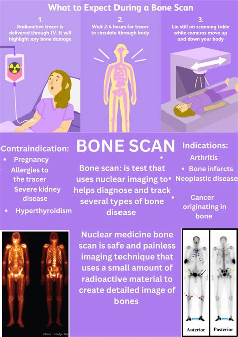 Naif Alanazi On Linkedin Poster In Bone Scan In Nuclear Medicine