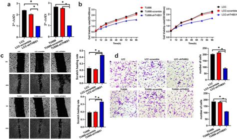 Thbs1 Promotes The Proliferation Migration And Invasion Of Laryngeal Download Scientific