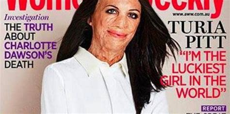Burn Survivor Turia Pitt Discusses Life Love And Beauty Yourtango