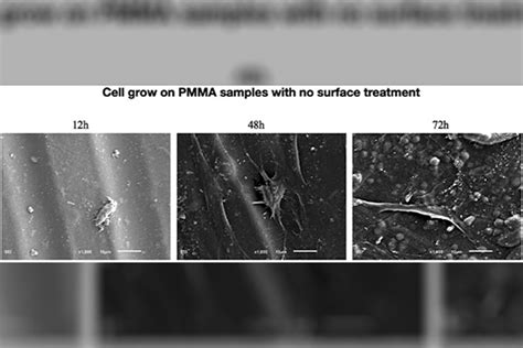 The Impact Of Customized Surface Topography And Porosity Created By Additive Manufacturing